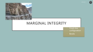 Principle of tooth preparation | PPTX