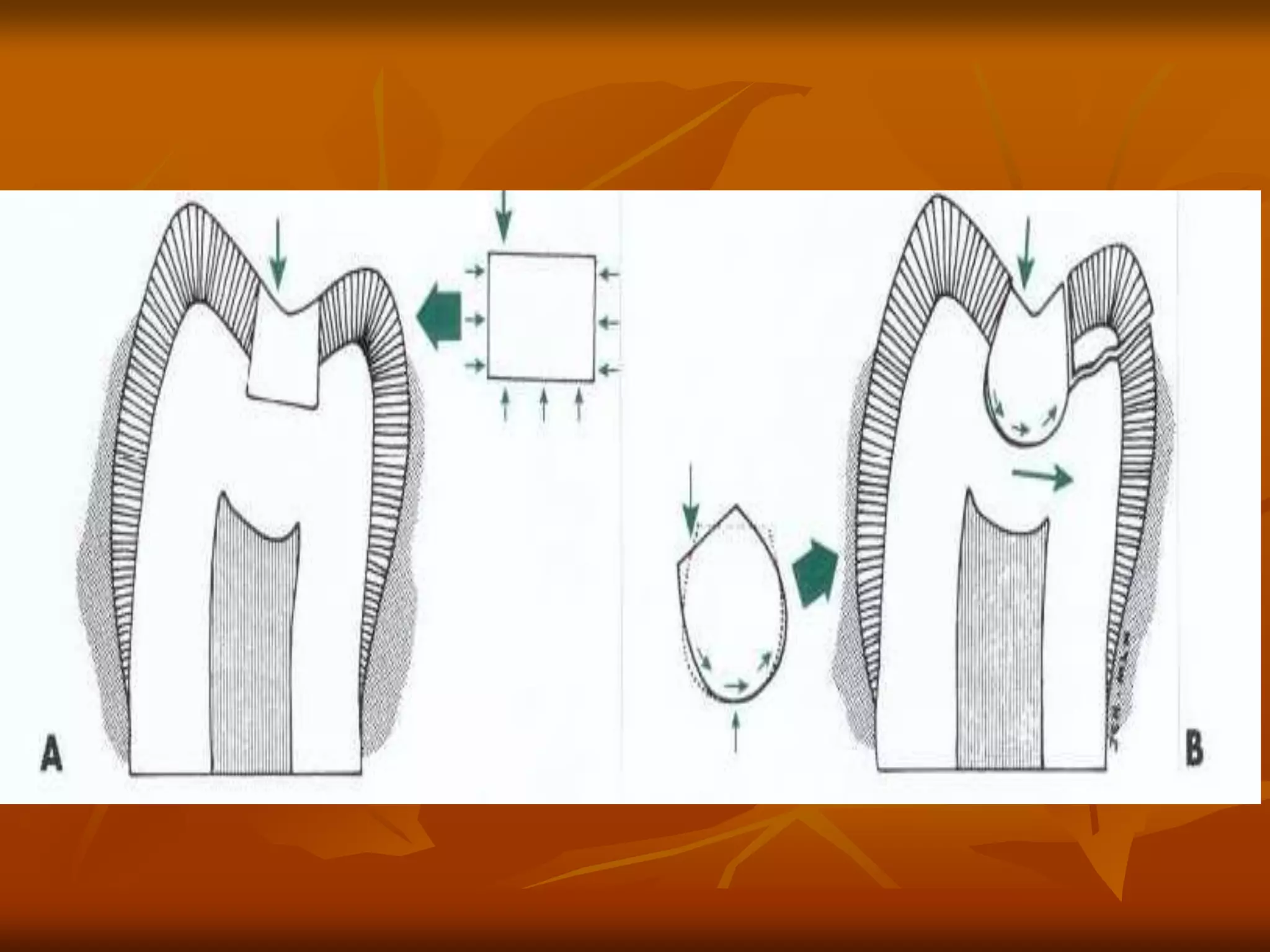 principle of tooth preparation.pptx