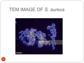 Principle of transmission electron microscope. | PPTX