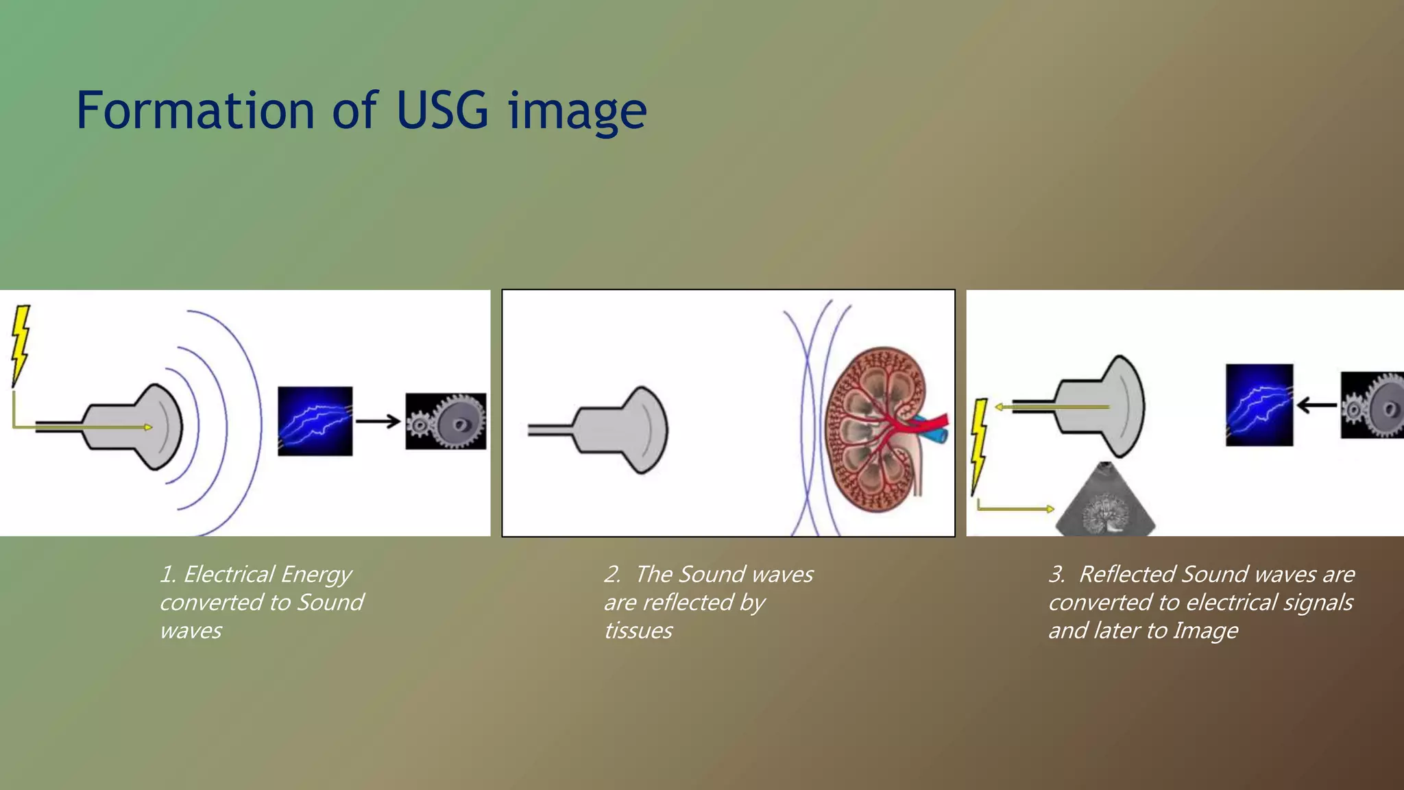 Principle of usg imaging, construction of transducers | PPTX
