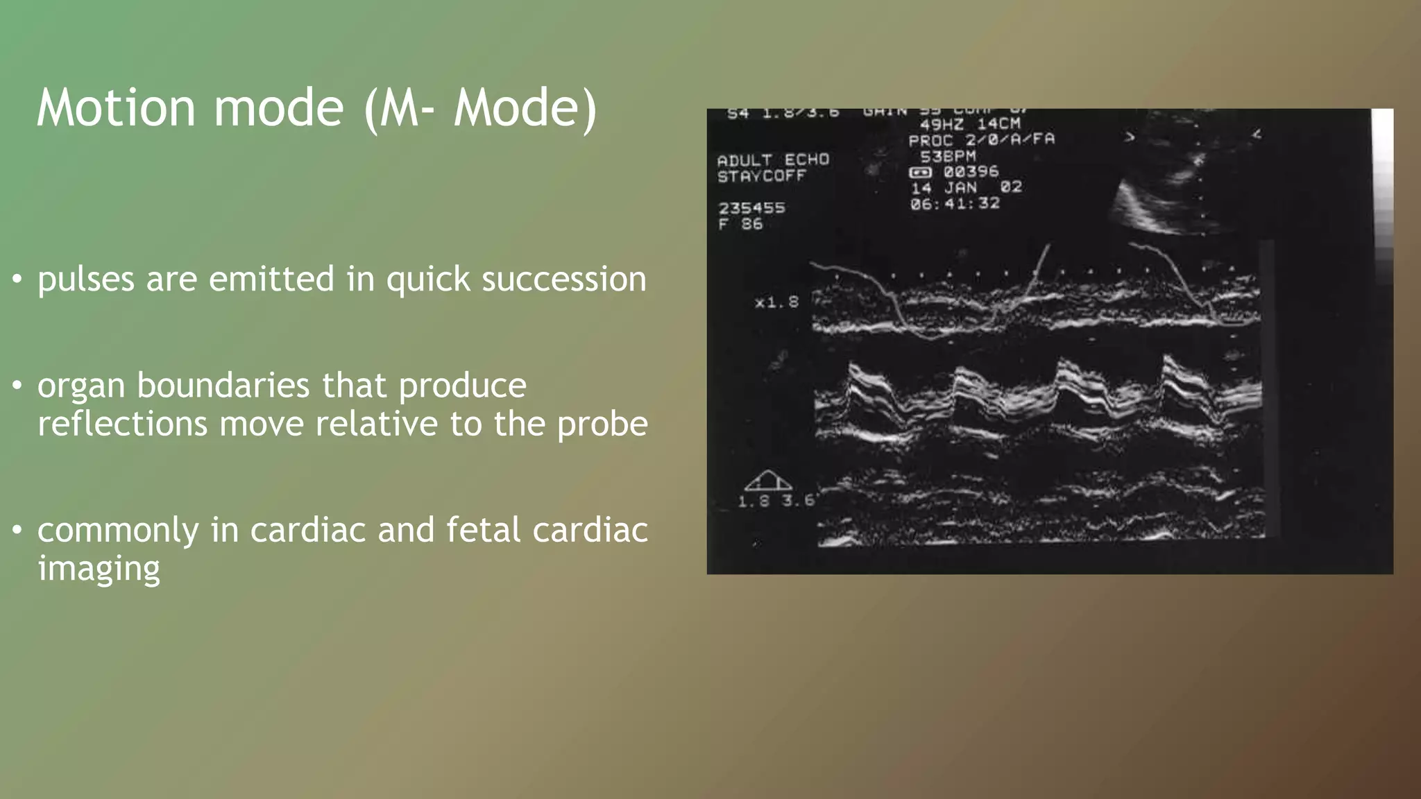 Principle of usg imaging, construction of transducers | PPTX