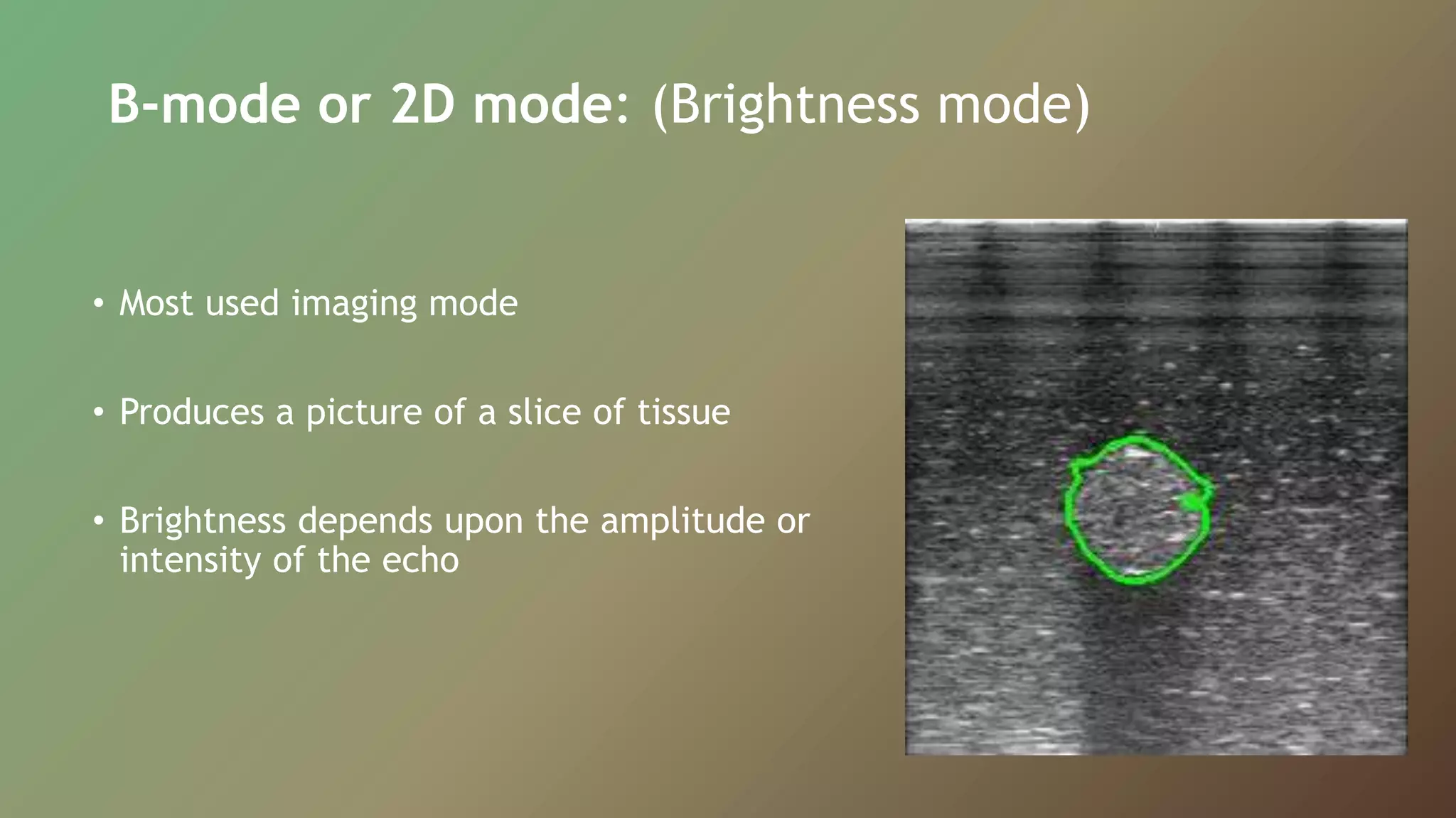 Principle of usg imaging, construction of transducers | PPTX