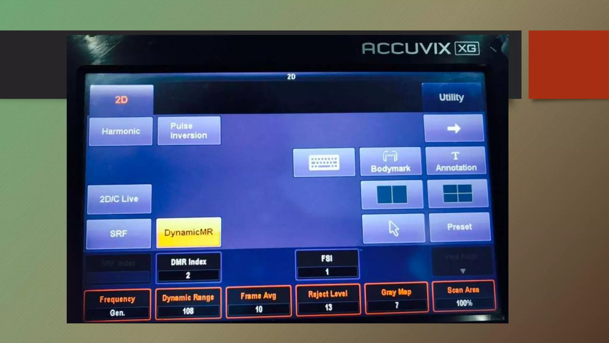 Principle of usg imaging, construction of transducers | PPTX