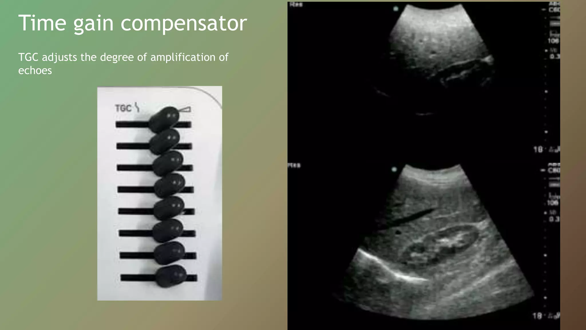 Principle of usg imaging, construction of transducers | PPTX