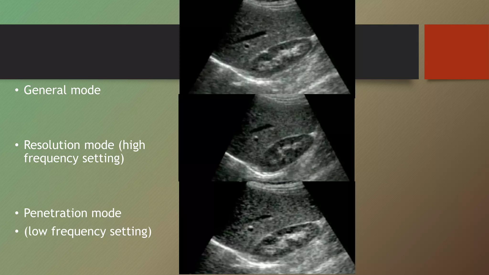 Principle of usg imaging, construction of transducers | PPTX