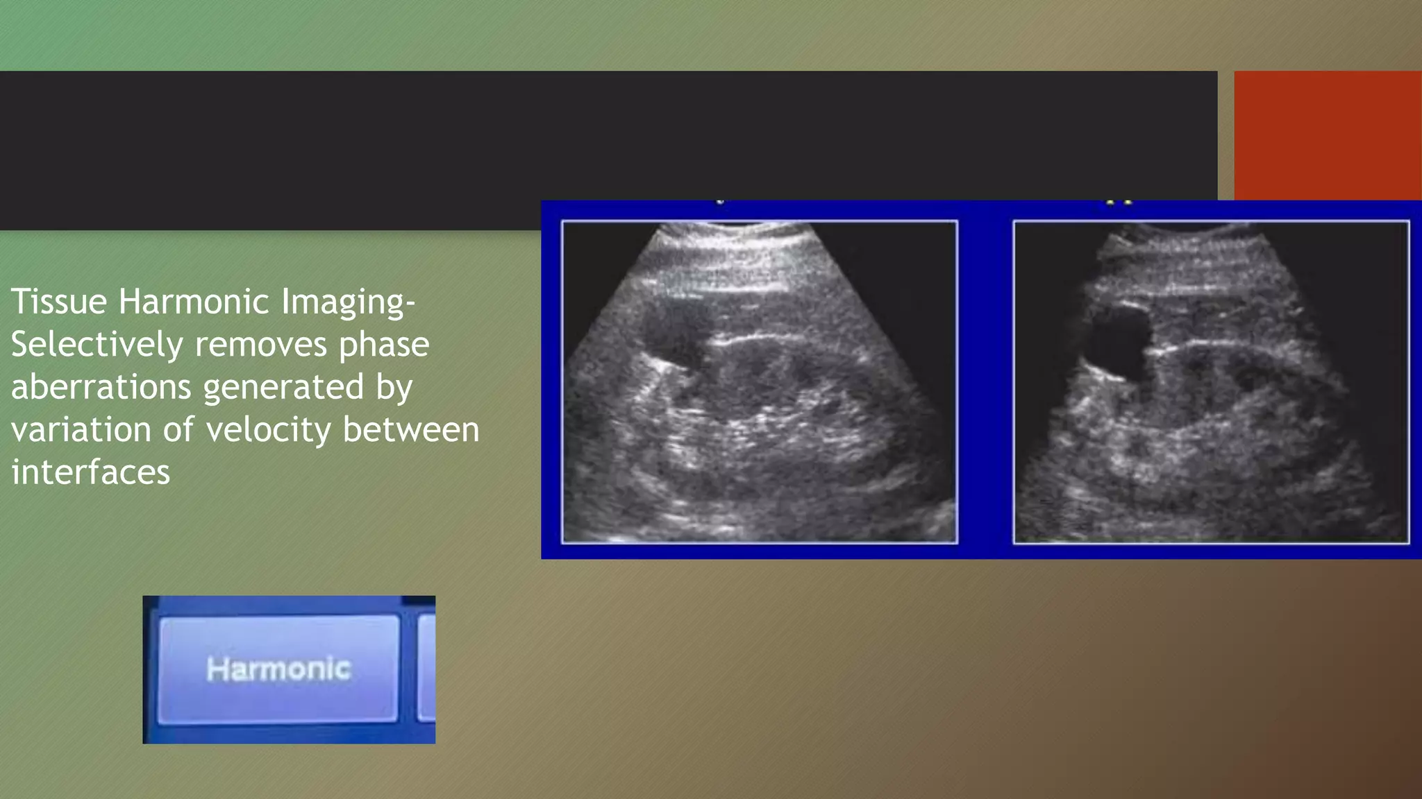 Principle of usg imaging, construction of transducers | PPTX