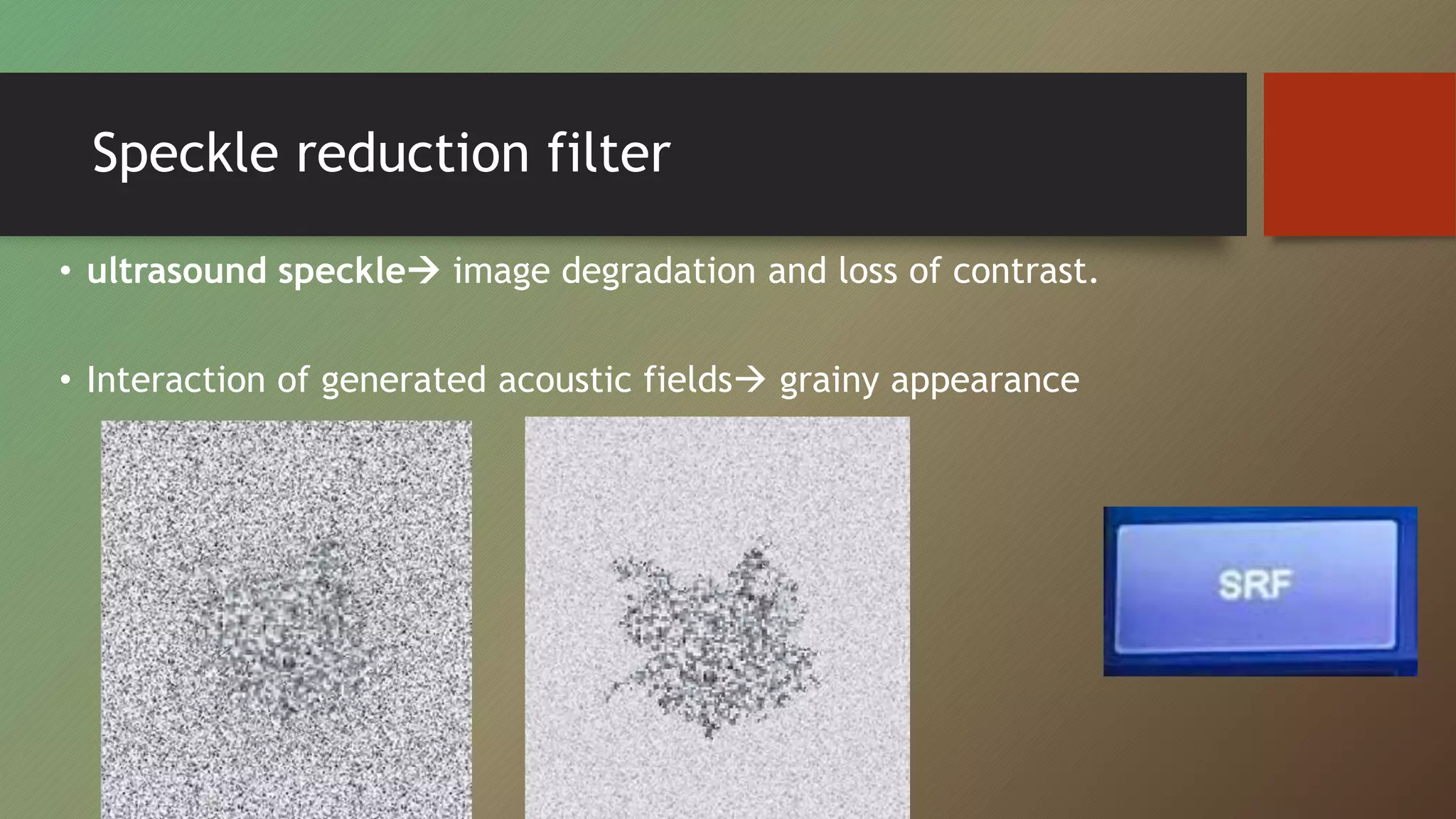 Principle of usg imaging, construction of transducers | PPTX