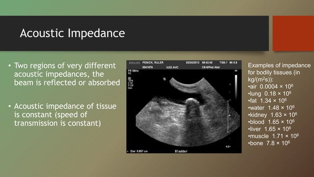 Principle of usg imaging, construction of transducers | PPT