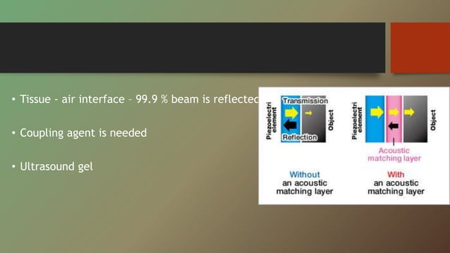 Principle of usg imaging, construction of transducers | PPTX | Digital ...