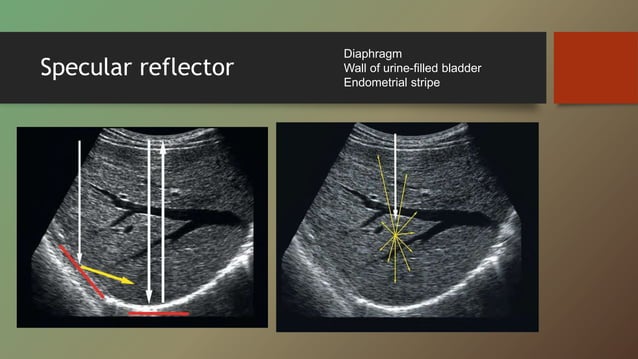 Principle of usg imaging, construction of transducers | PPT