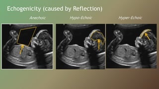 Principle of usg imaging, construction of transducers | PPTX