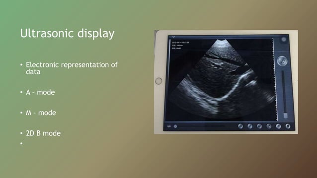 Principle of usg imaging, construction of transducers | PPTX | Digital ...