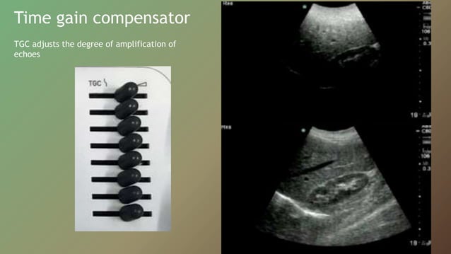 Principle of usg imaging, construction of transducers | PPT
