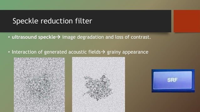 Principle of usg imaging, construction of transducers | PPT
