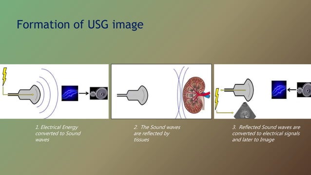 Principle of usg imaging, construction of transducers | PPT