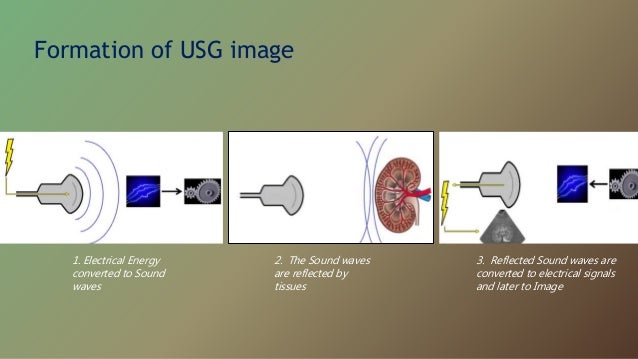 Principle of usg imaging, construction of transducers