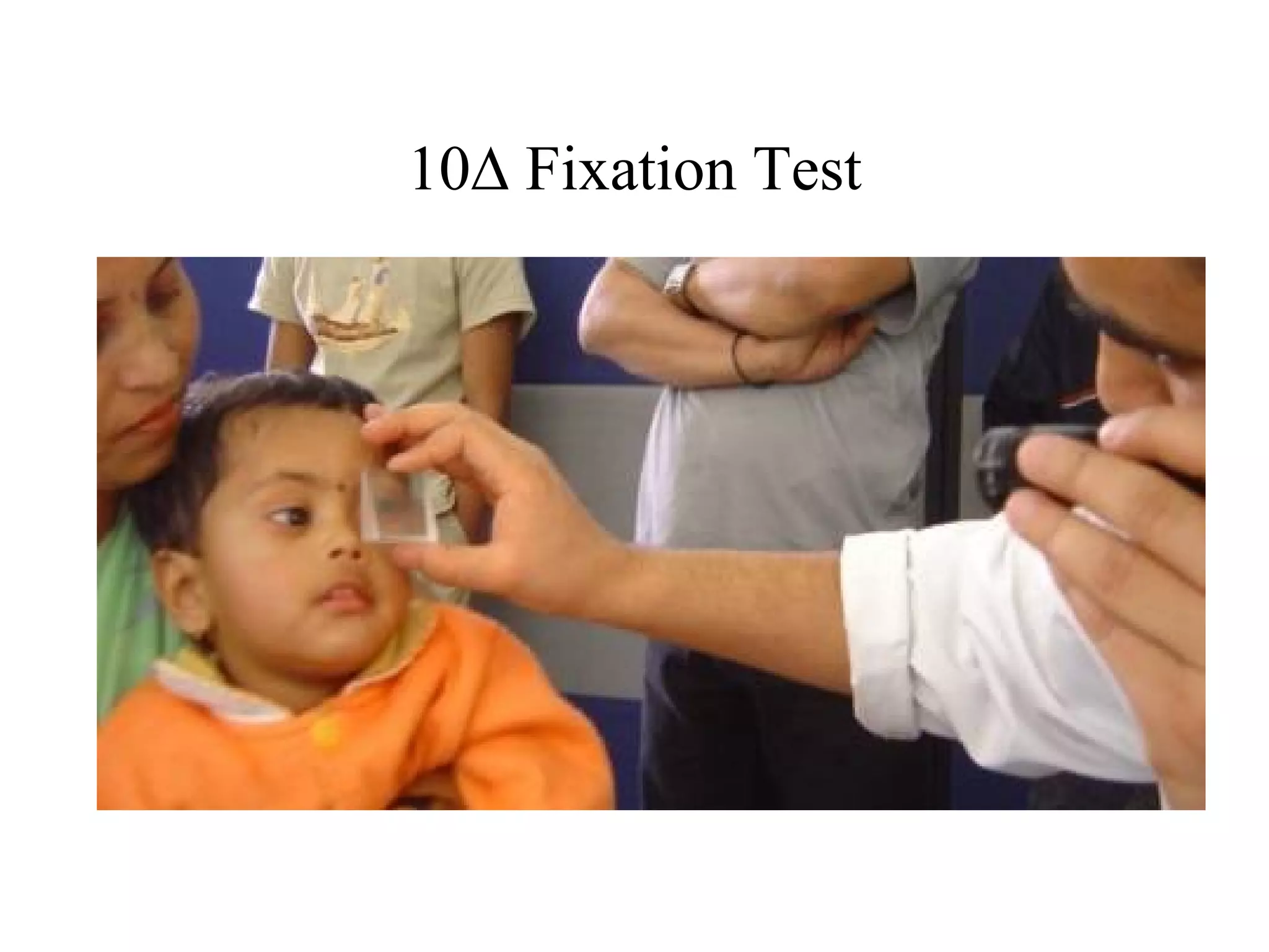 Principle of visual acuity charts class | PPT