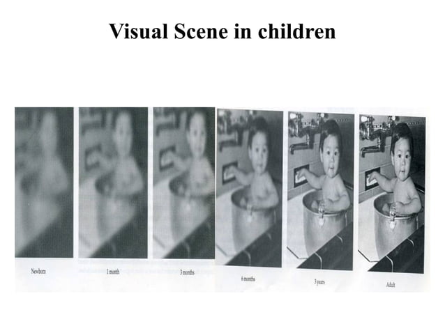 Principle of visual acuity charts class | PPT