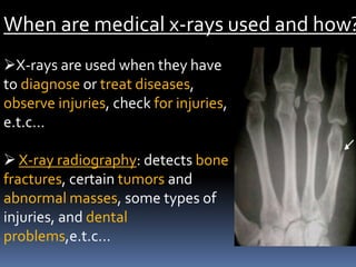 X-Ray's | PPTX