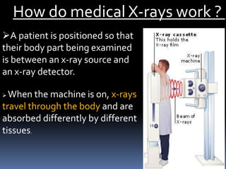 X-Ray's | PPTX