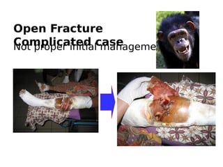 Principles-fracture-management - Presentation slide (2).pdf