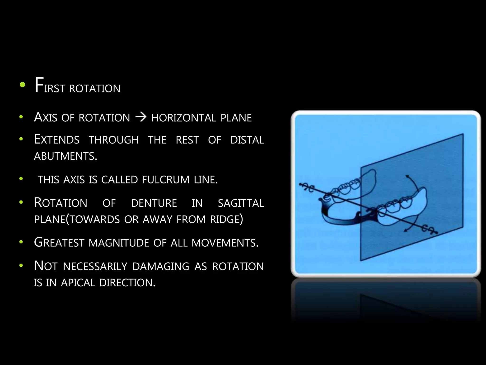 Principles of designing in Removable Partial dentures | PPTX