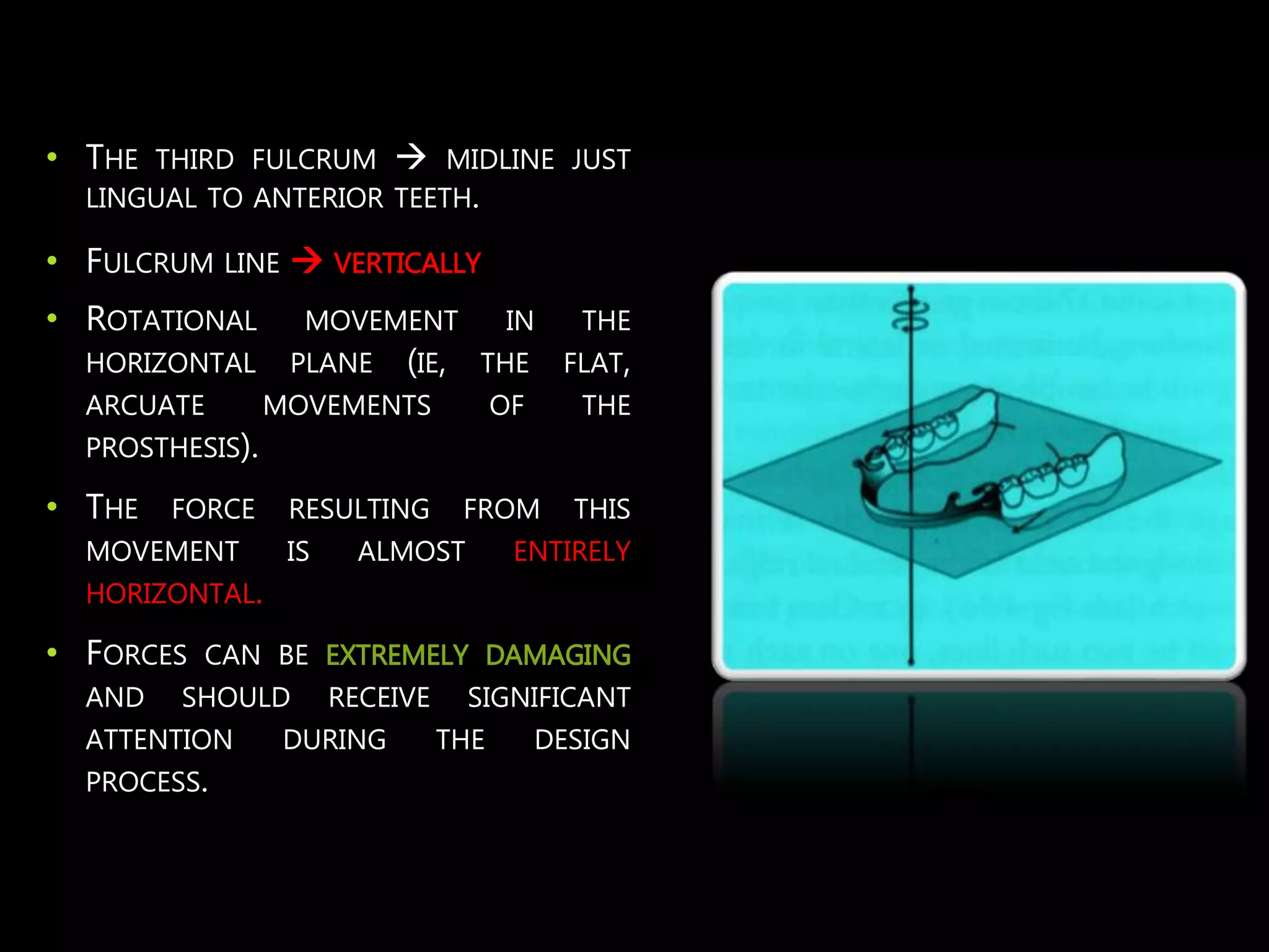 Principles of designing in Removable Partial dentures | PPTX