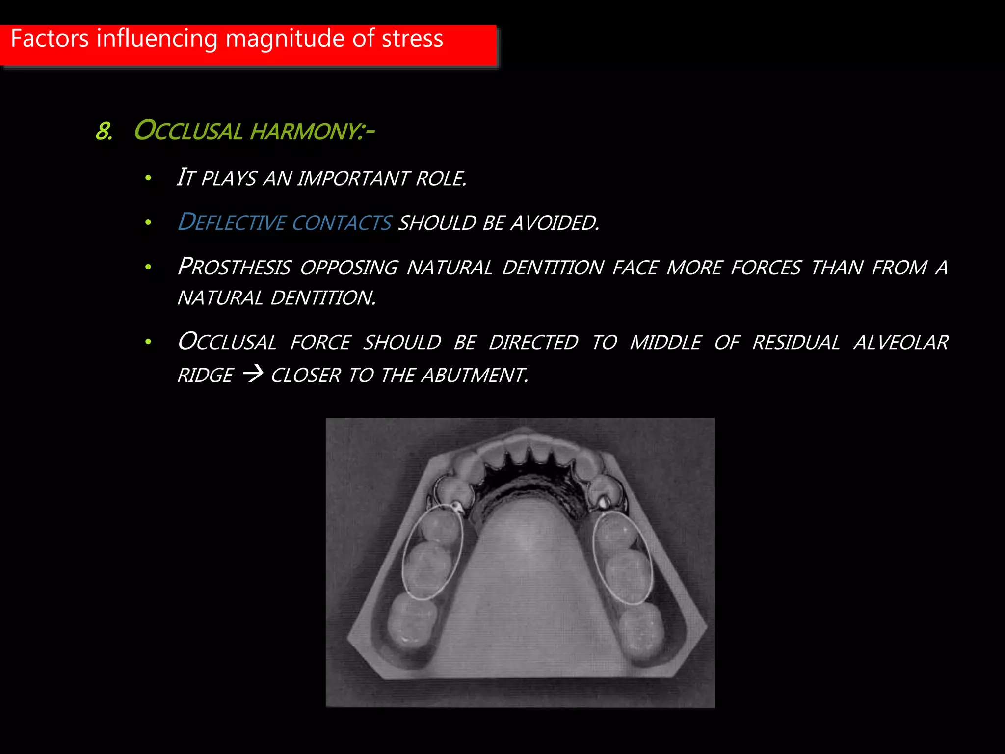 Principles of designing in Removable Partial dentures | PPTX