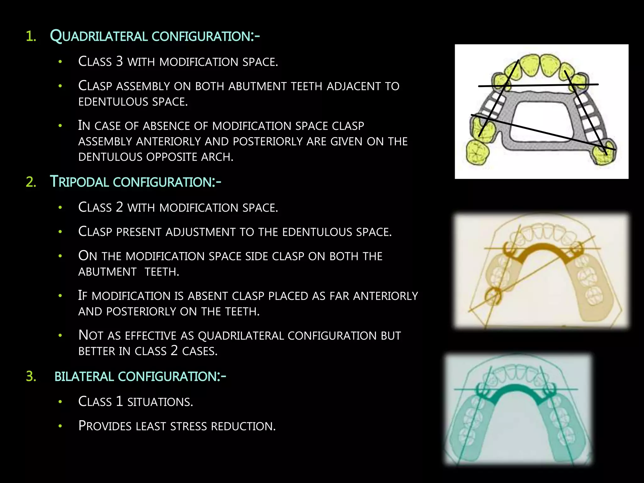 Principles of designing in Removable Partial dentures | PPTX