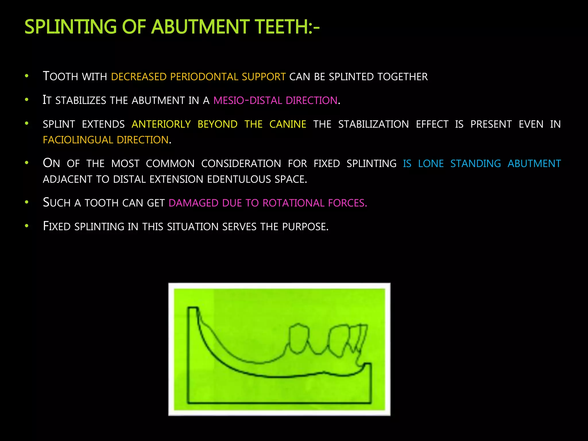Principles of designing in Removable Partial dentures | PPTX