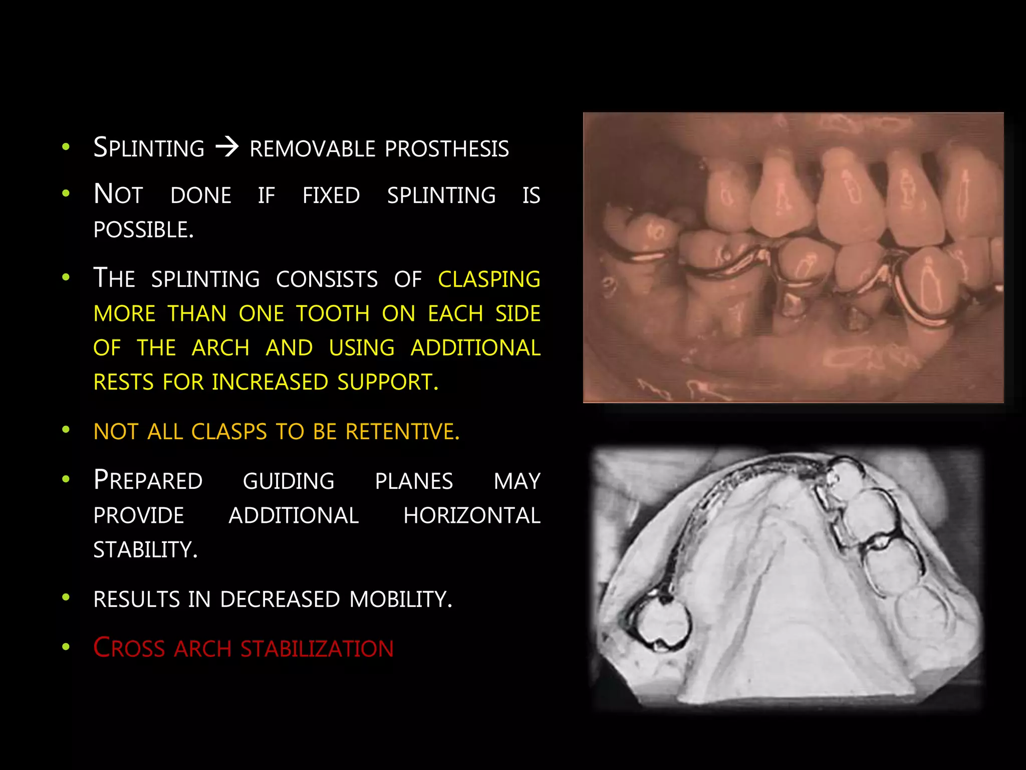 Principles of designing in Removable Partial dentures | PPTX