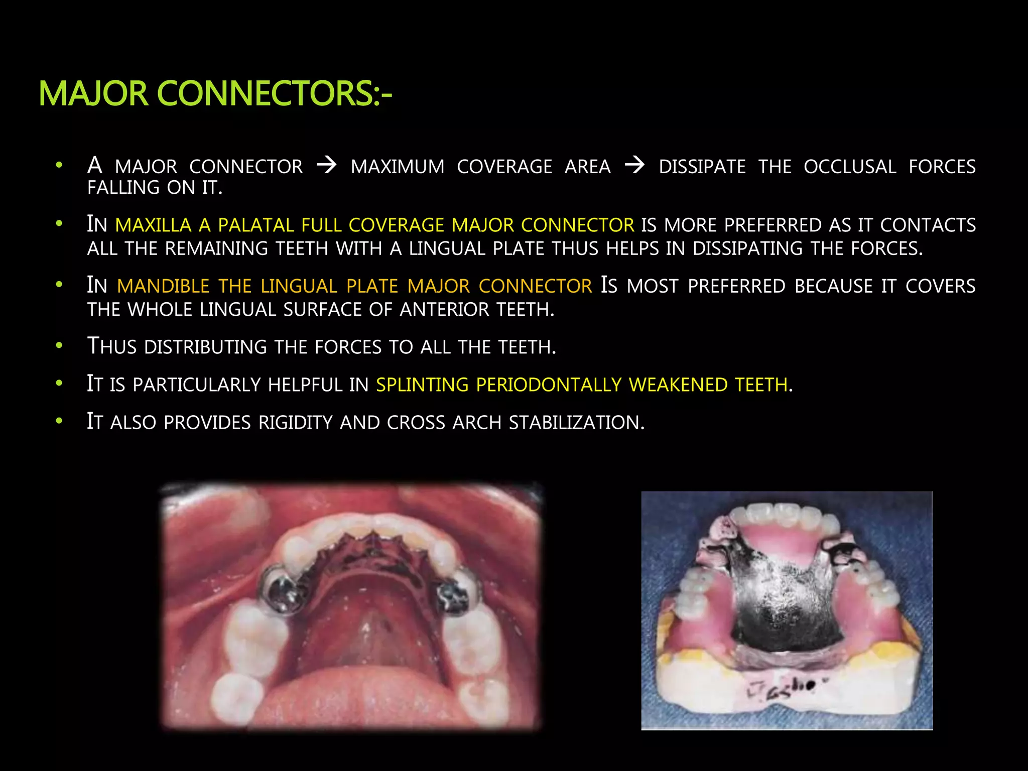 Principles of designing in Removable Partial dentures | PPTX