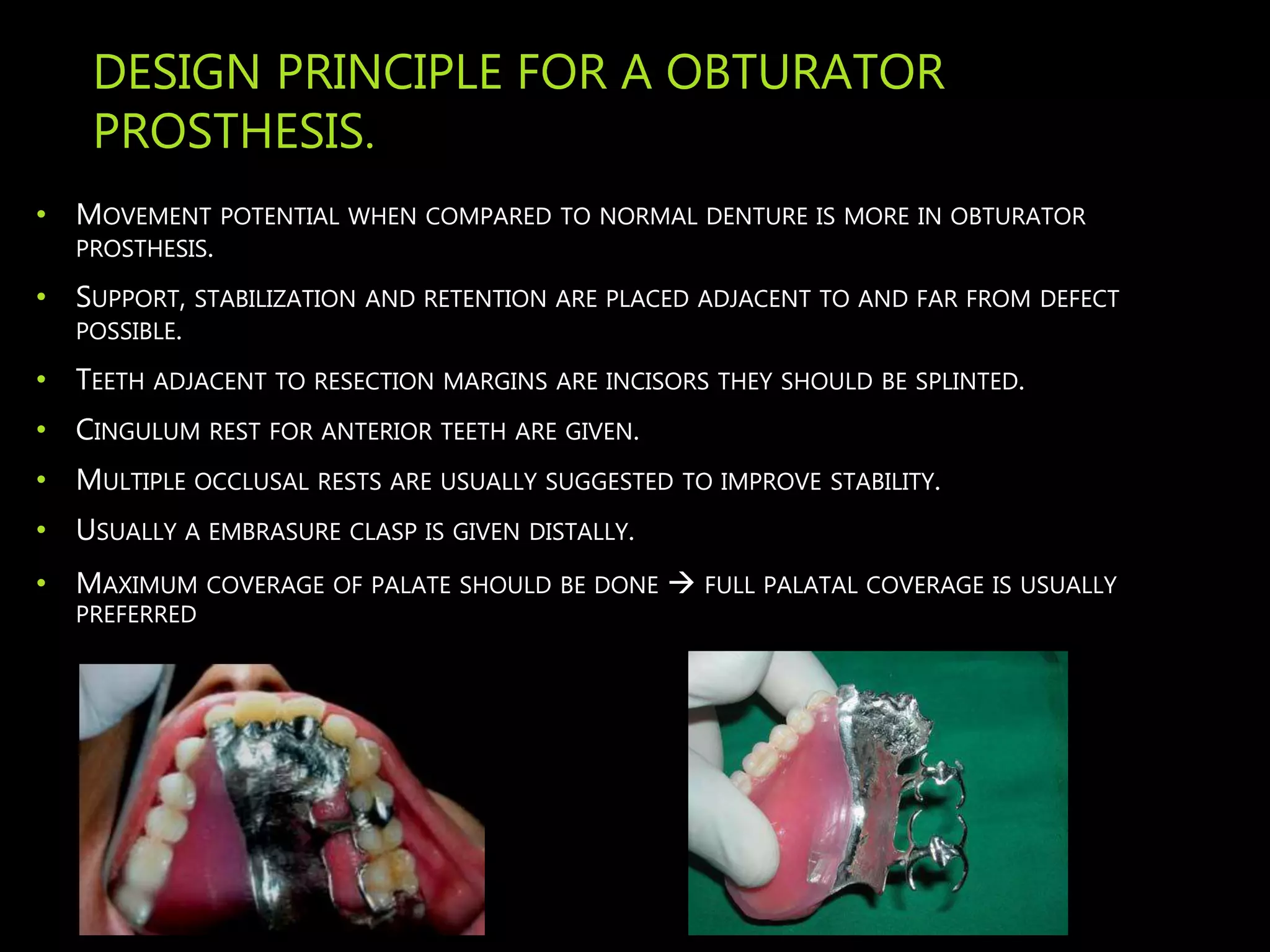 Principles of designing in Removable Partial dentures | PPTX