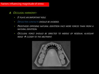 Principles of designing in Removable Partial dentures | PPTX