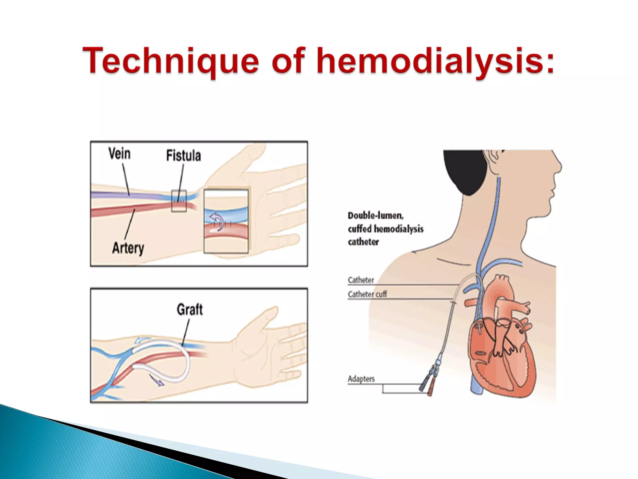Principles of-hemodialysis | PPT