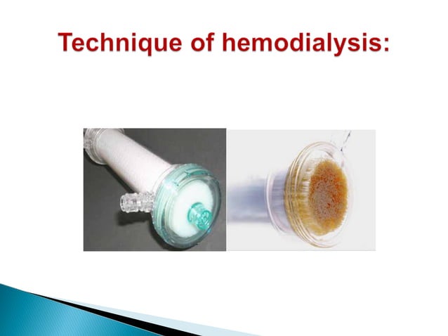 Principles of-hemodialysis | PPT | Blood Disorders | Diseases and Conditions
