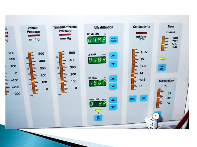 Principles of-hemodialysis | PPT | Blood Disorders | Diseases and ...