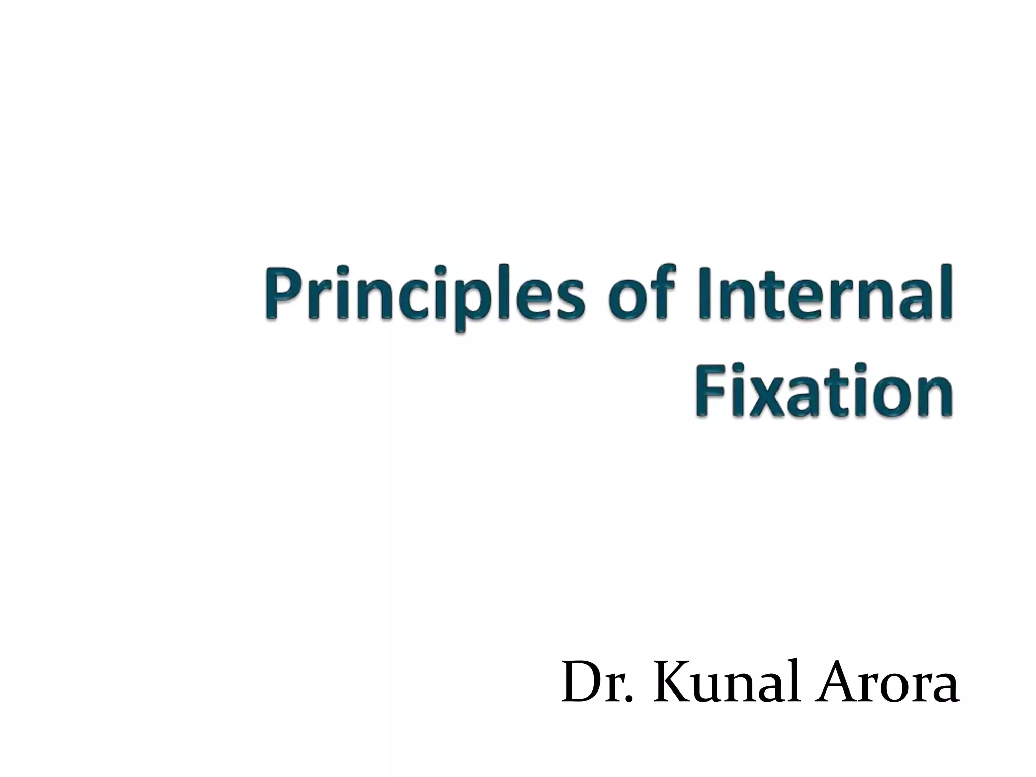 Principles of-internal-fixation | PPT
