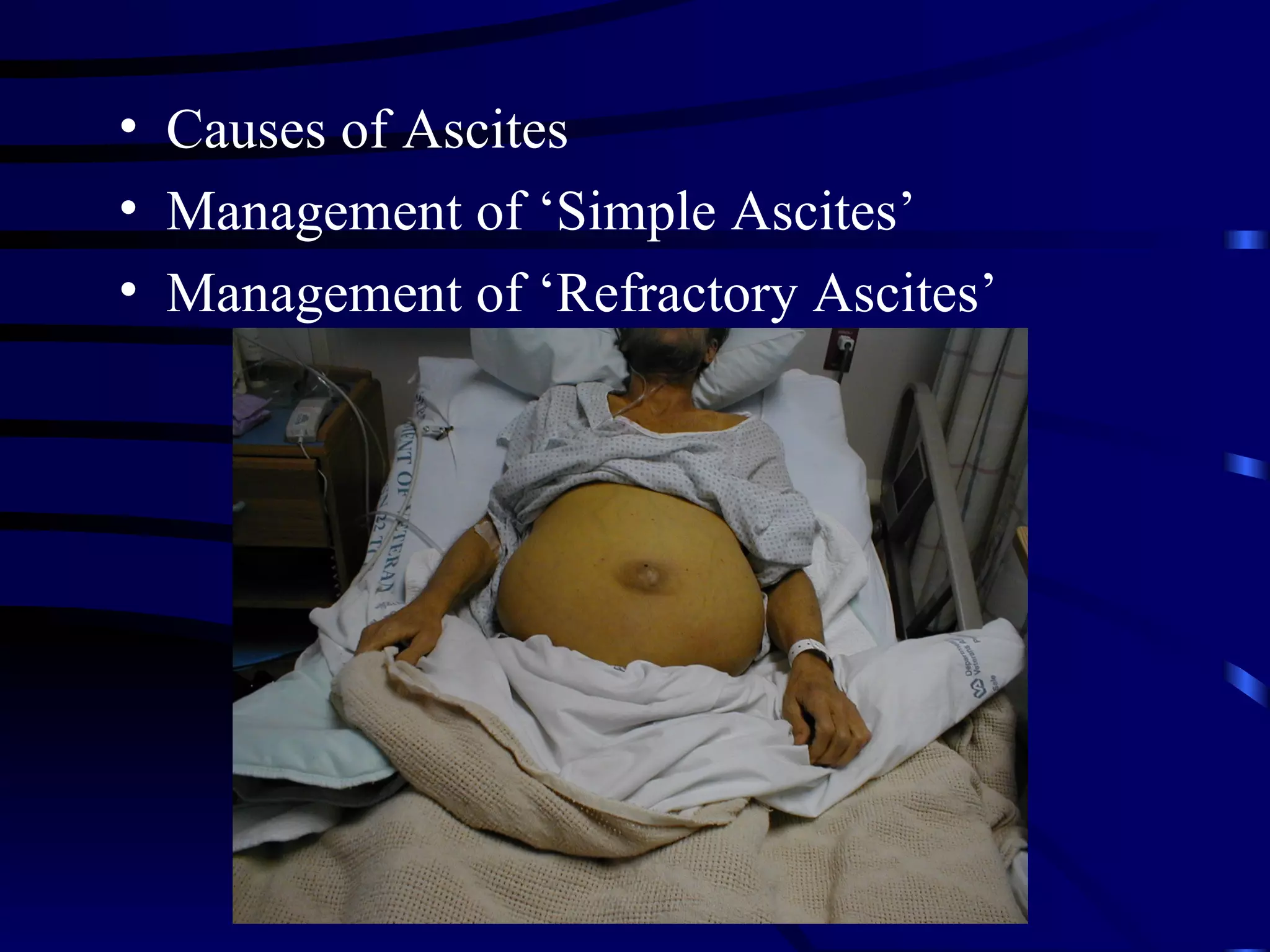Principles Of Management Of Ascites Combined | PPT