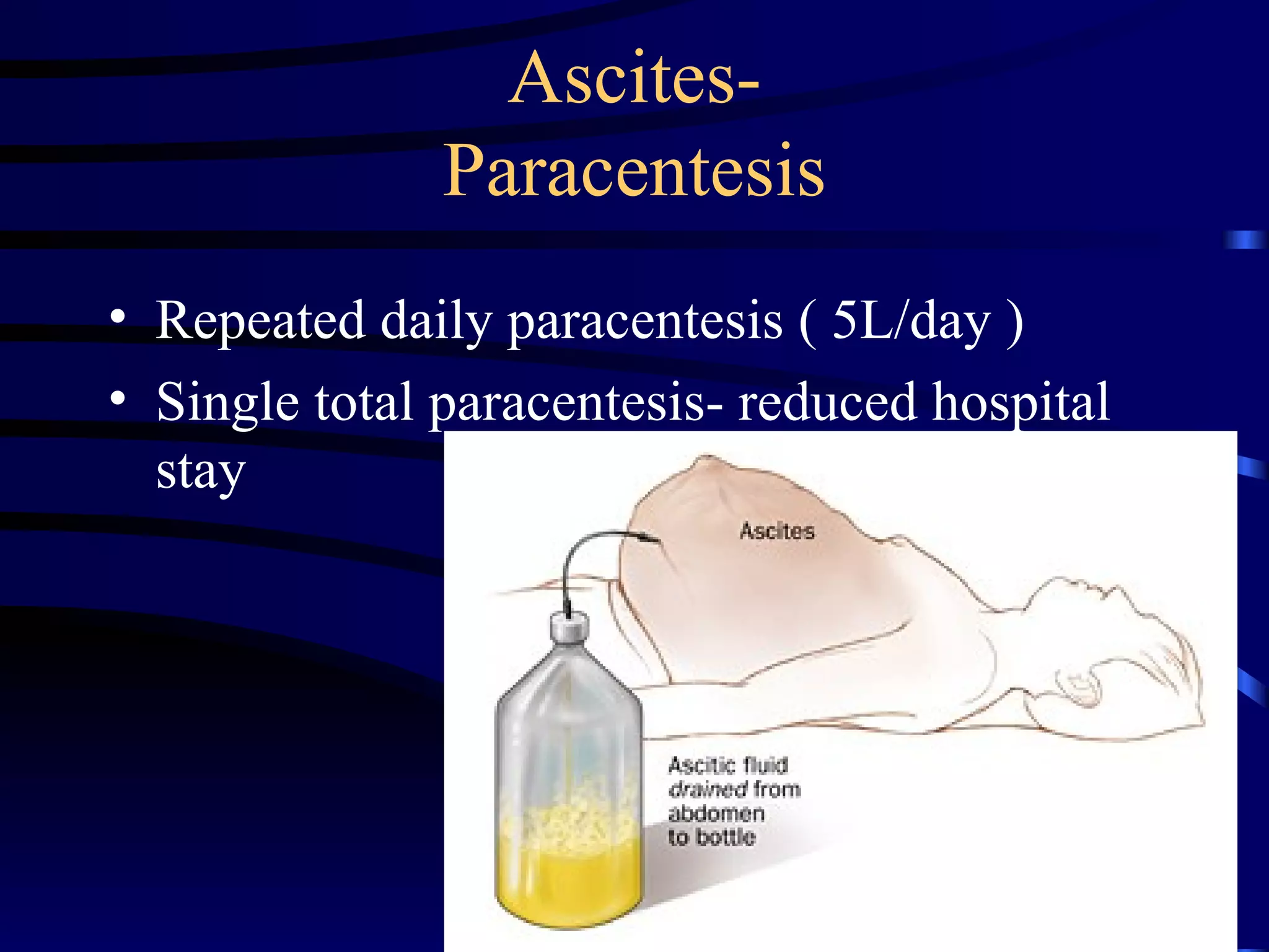 Principles Of Management Of Ascites Combined | PPT