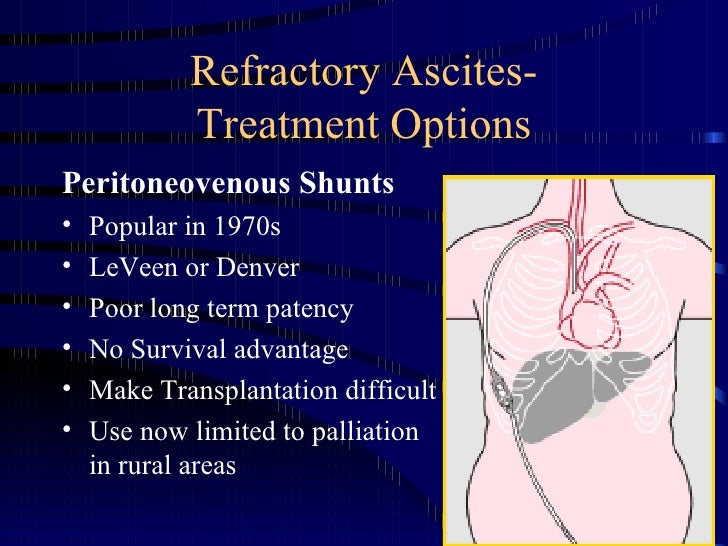 Principles Of Management Of Ascites Combined