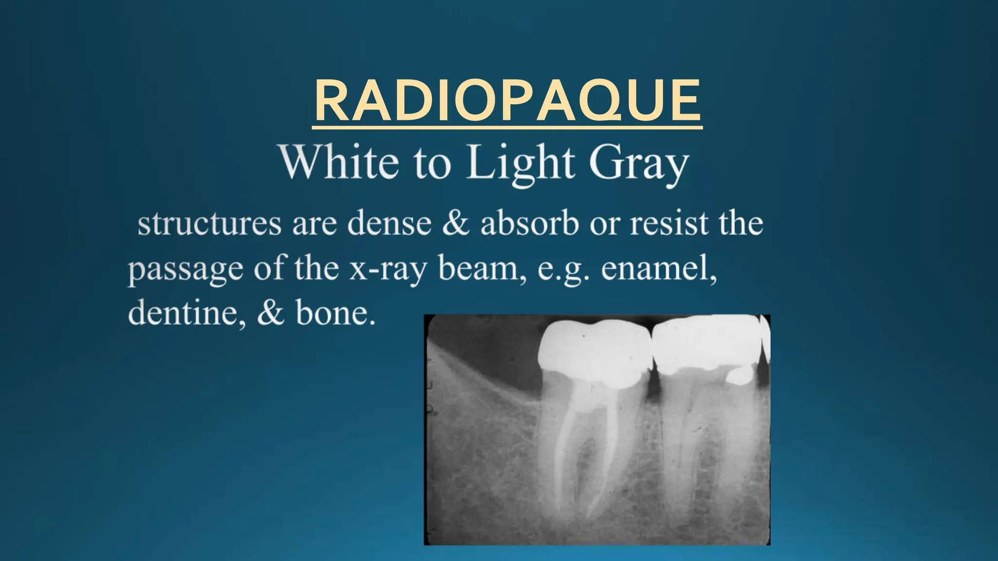Principles-of-Radiographic dental radio.doc