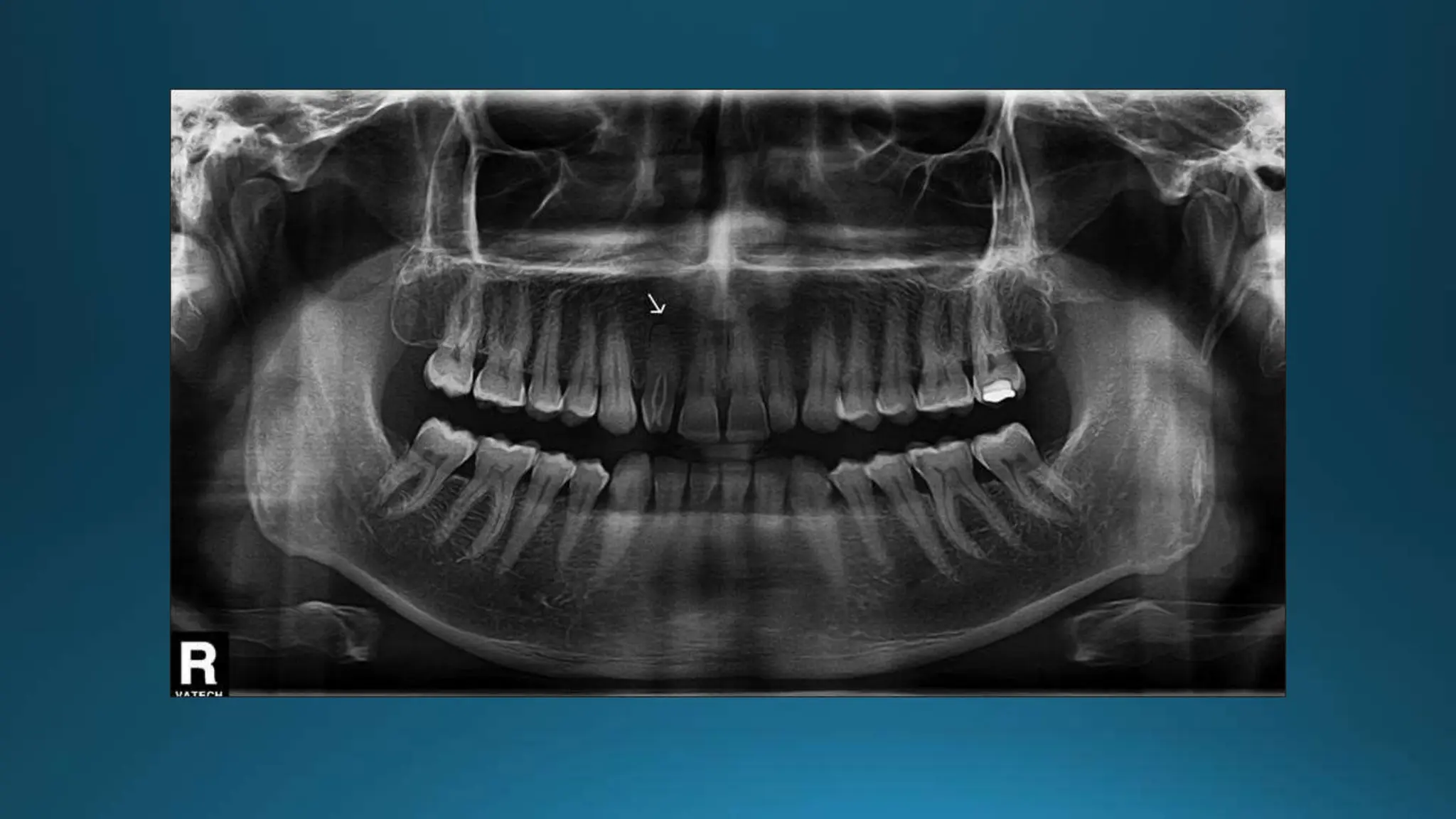 Principles-of-Radiographic dental radio.doc