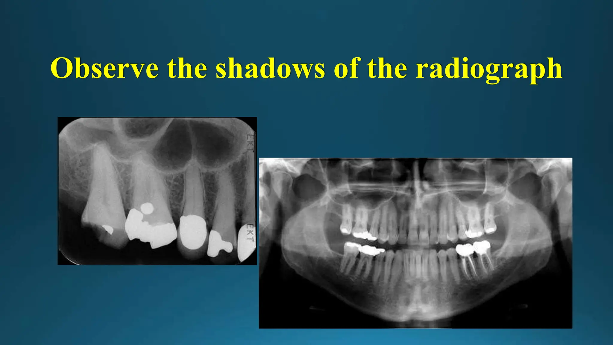 Principles-of-Radiographic dental radio.doc