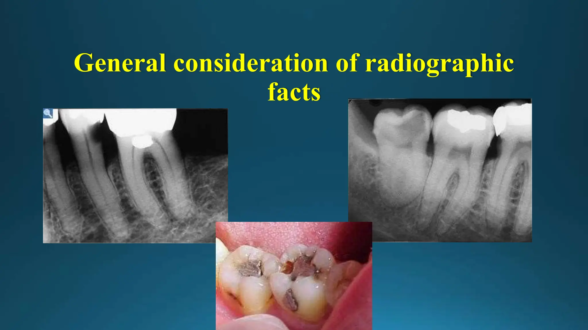 Principles-of-Radiographic dental radio.doc