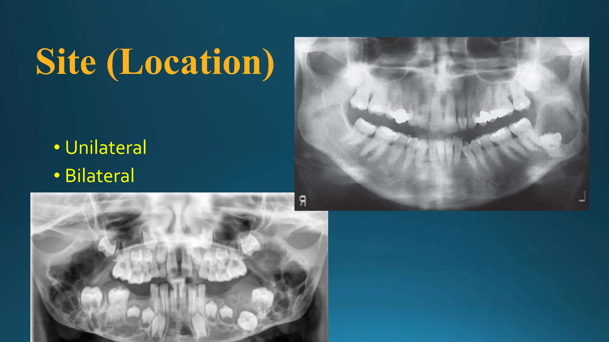 Principles-of-Radiographic dental radio.doc