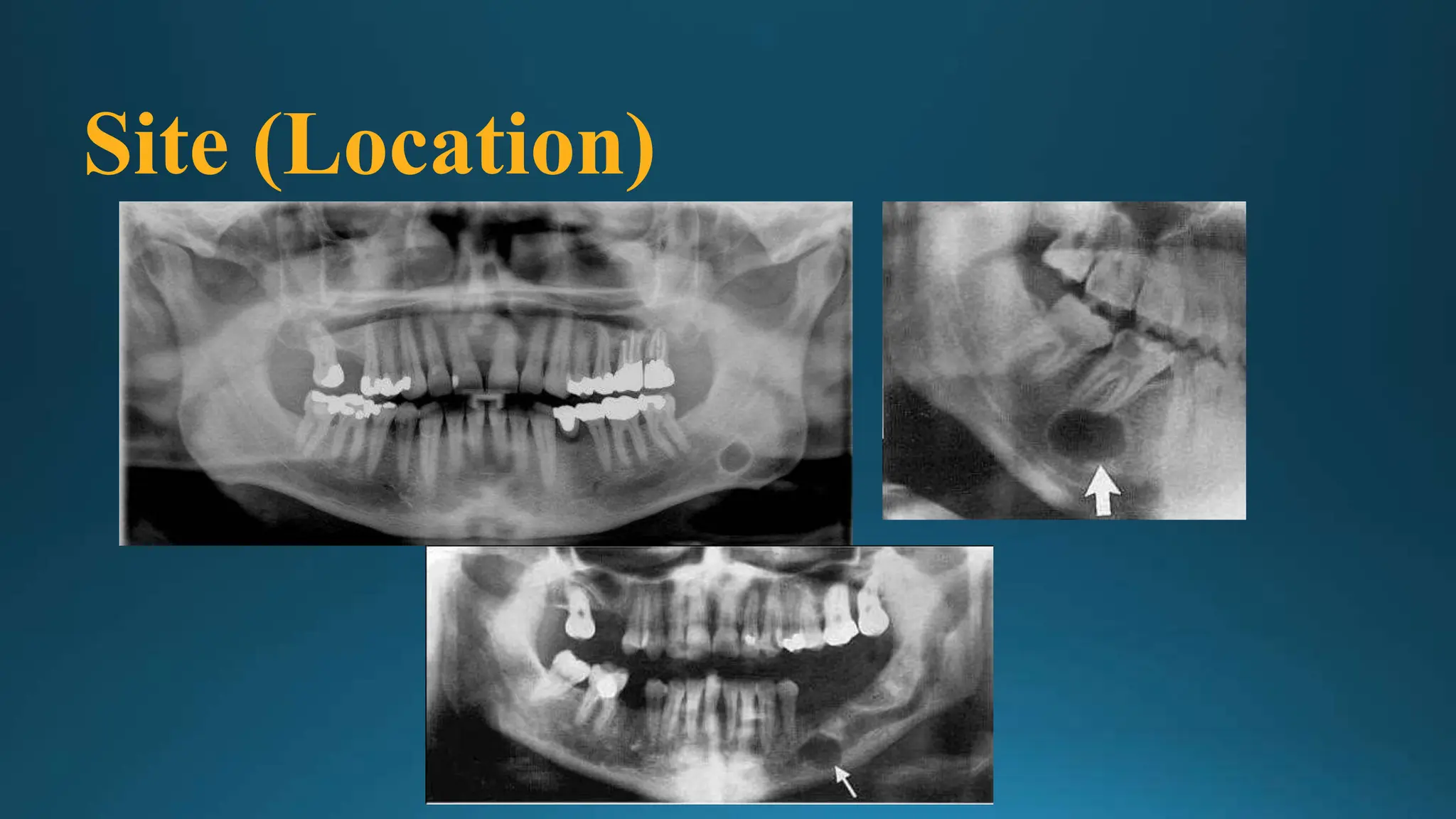 Principles-of-Radiographic dental radio.doc