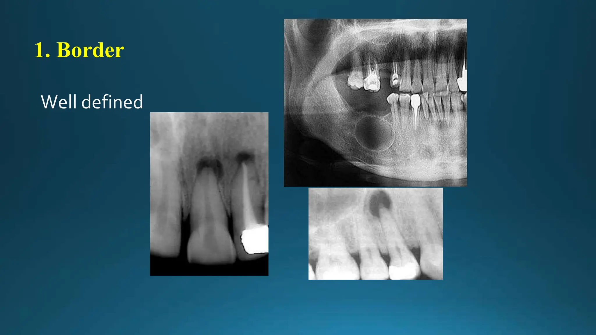 Principles-of-Radiographic dental radio.doc