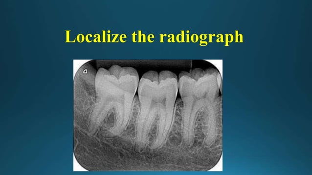 Principles-of-Radiographic dental radio.doc