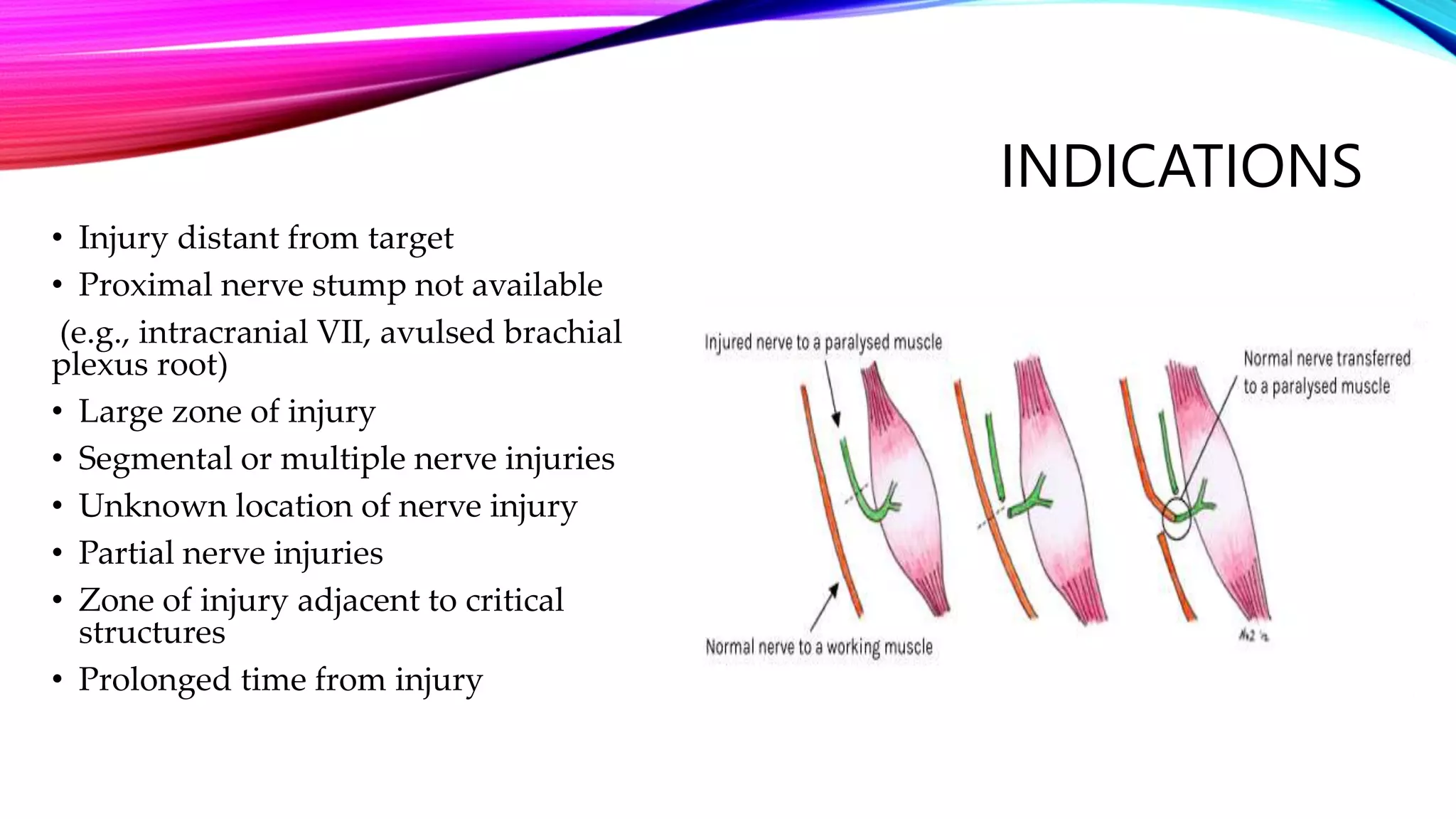 Principles and applications of Nerve transfer by Maheen Fatima.pptx